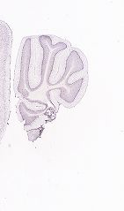 Transgenic Characterization Experiment Details :: Allen Brain Atlas ...